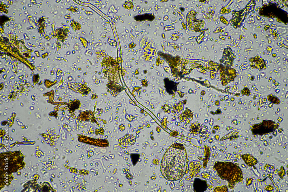soil microorganisms under a microscope including amoeba, flagellates ...