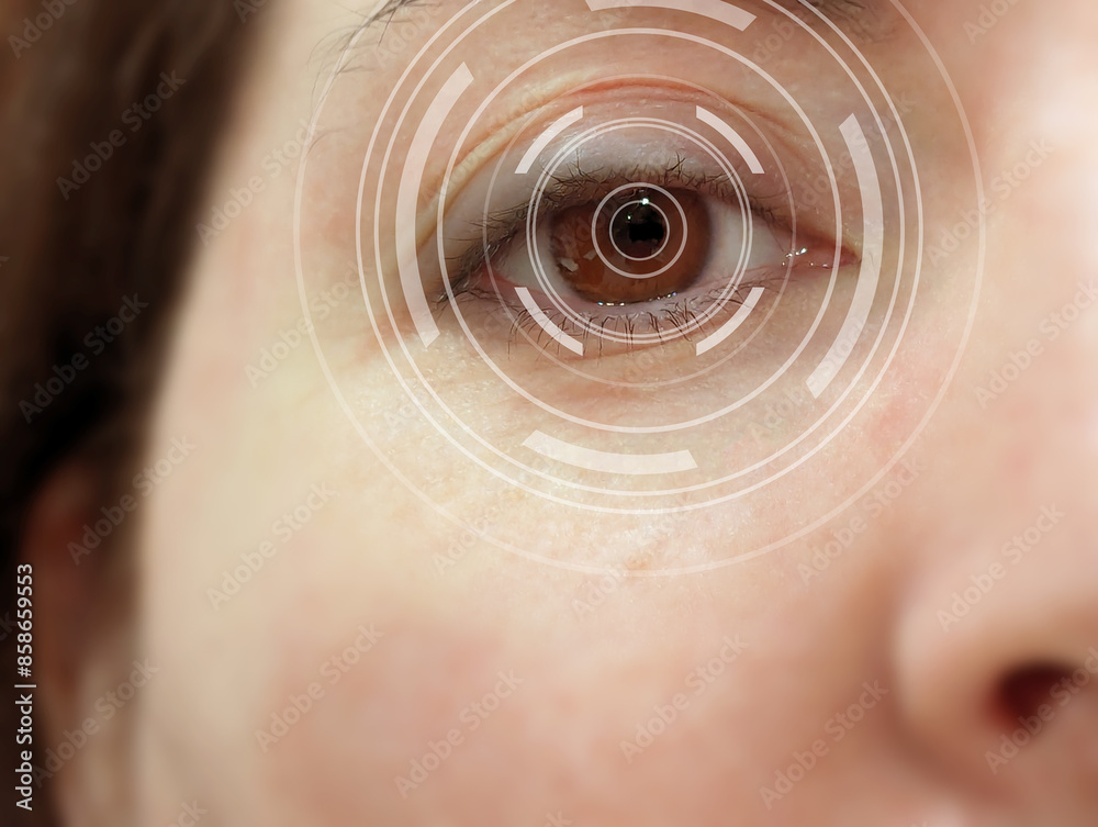 Close-up of eye scan with guides and templates for computerized eye ...