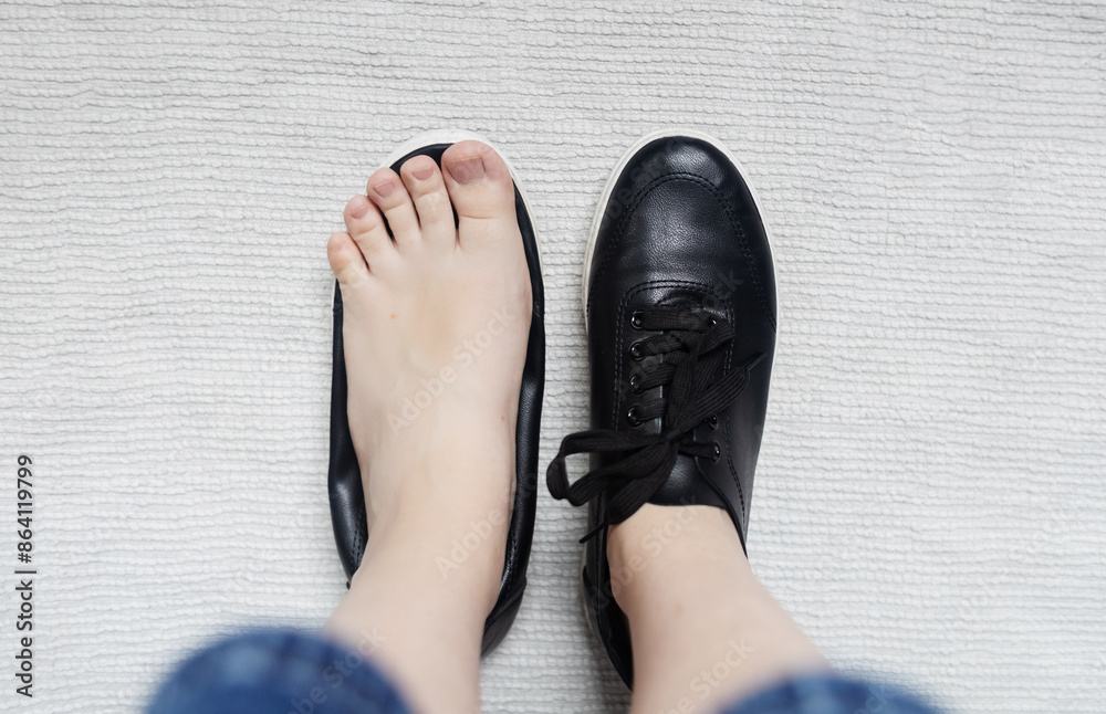 Foot deforming shoes. Incorrect anatomical shoes with flat soles. Small ...