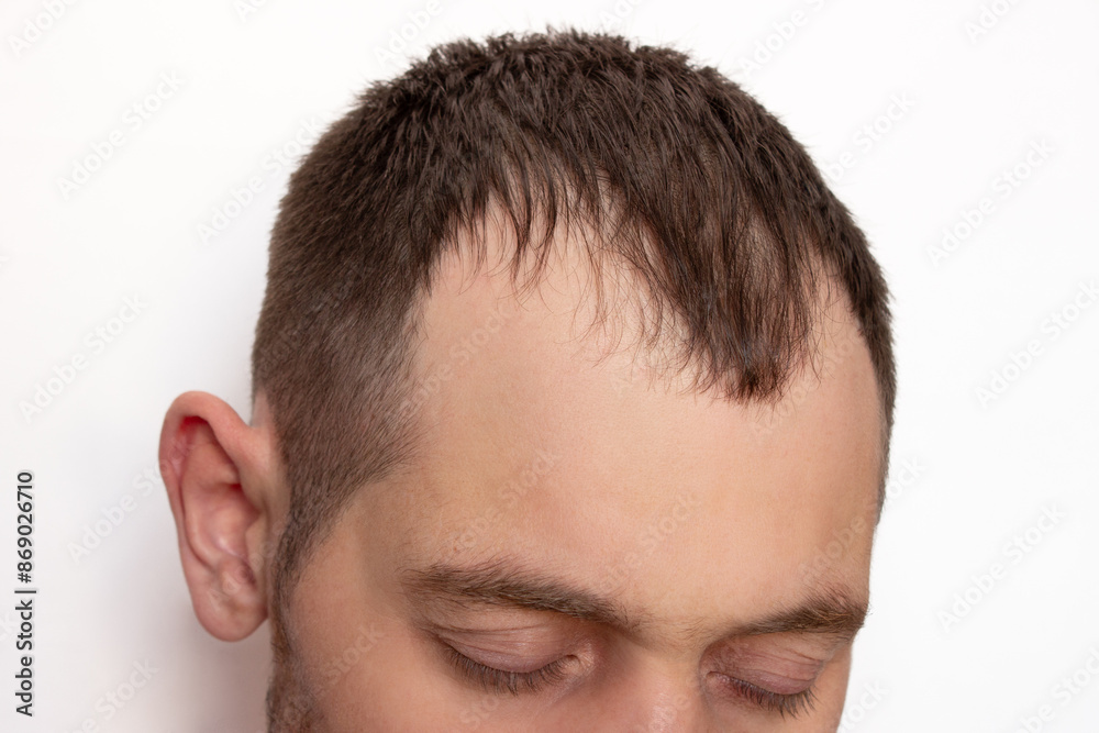 Head shot of a man with a receding hairline on a white background. Male ...