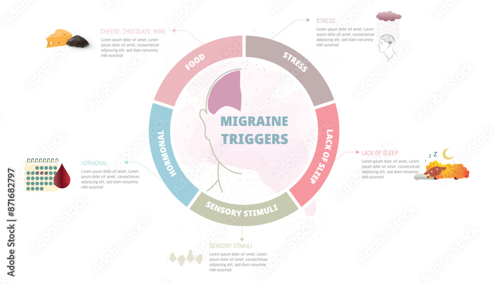 Diagram of migraine triggers.concepts causes migraines.The diagram is ...