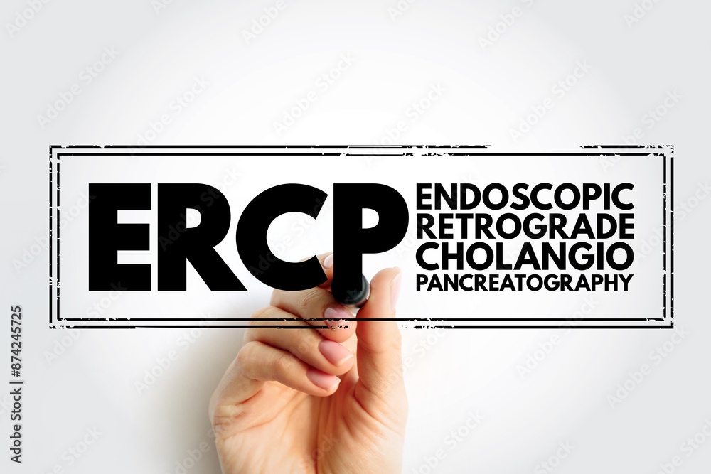 ERCP Endoscopic Retrograde CholangioPancreatography - procedure to ...