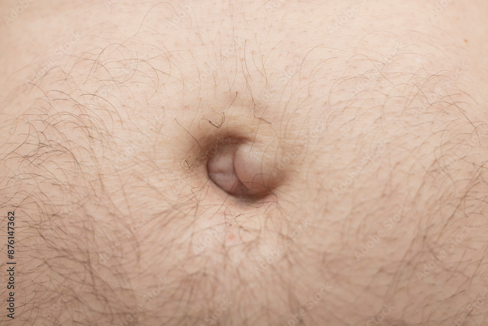 Lump In Belly Button Hernia An Inflammatory Condition Possible lump-in-belly-button-hernia-an-inflammatory-condition-possible