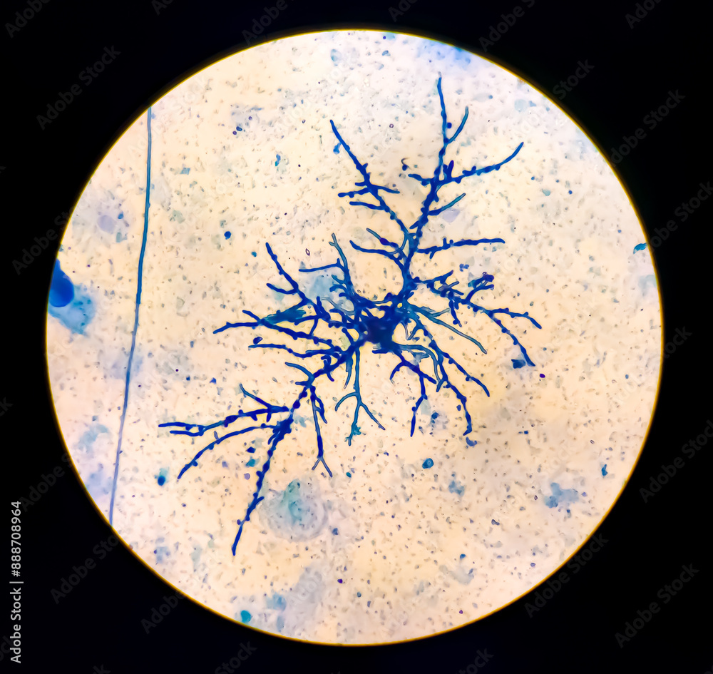 Candida Albicans yeast cell, pseudo hyphae with spores. Pseudohyphae ...
