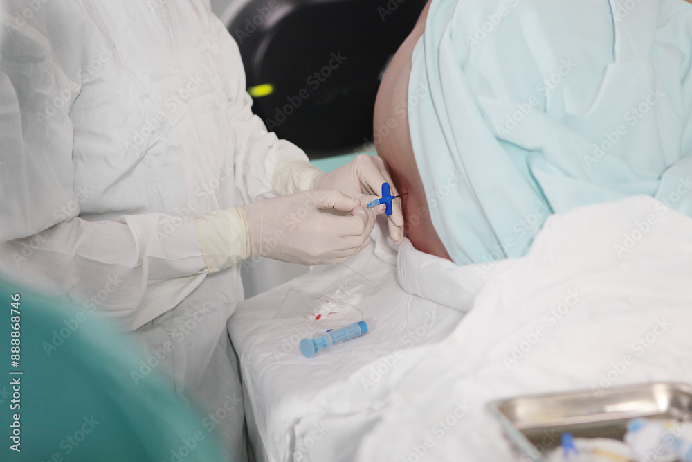 Blockade of the spinal nerve. Epidural anesthesia. Injections of ...