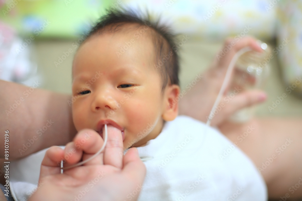 Finger feeding breast milk to Jaundice Asian infant boy by tube Stock ...