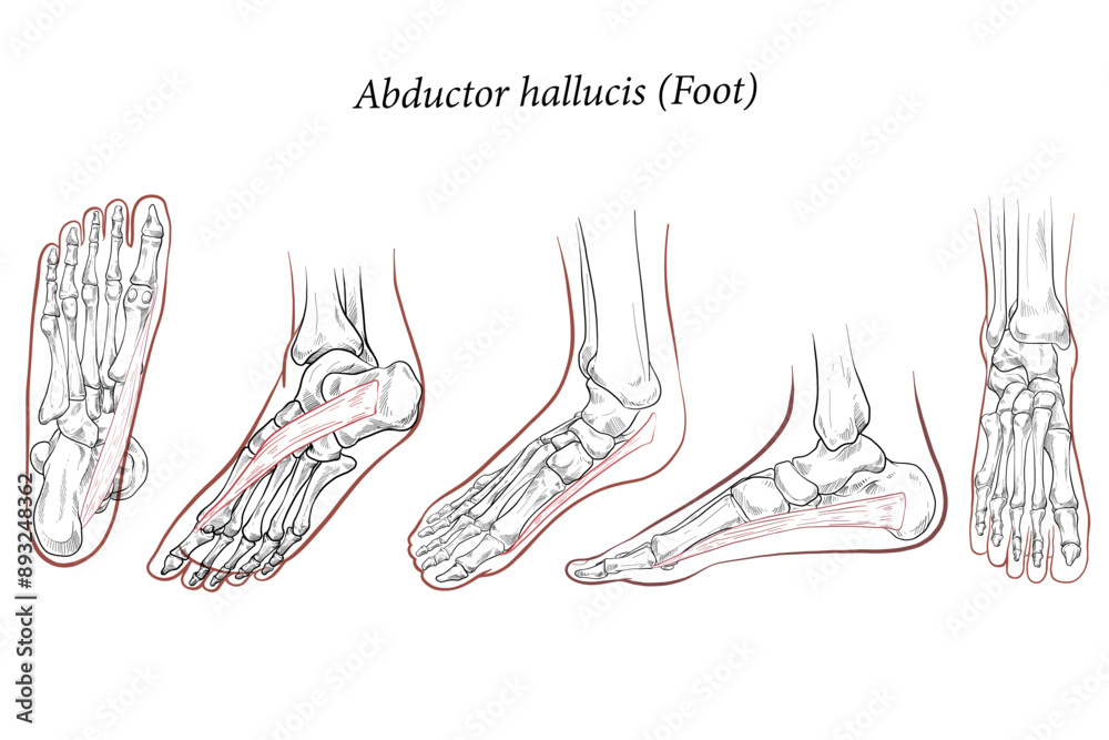Medical illustration of Abductor Hallucis muscle foot, oblique side ...