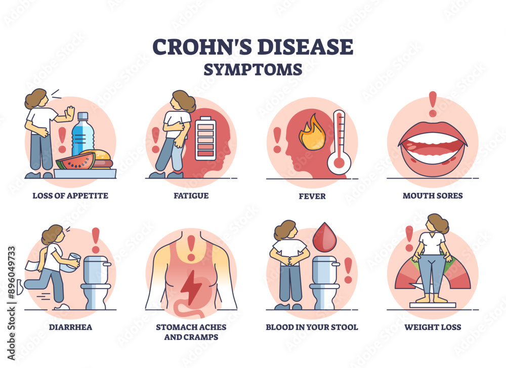 Crohns disease symptoms from inflammatory bowel illness outline diagram ...