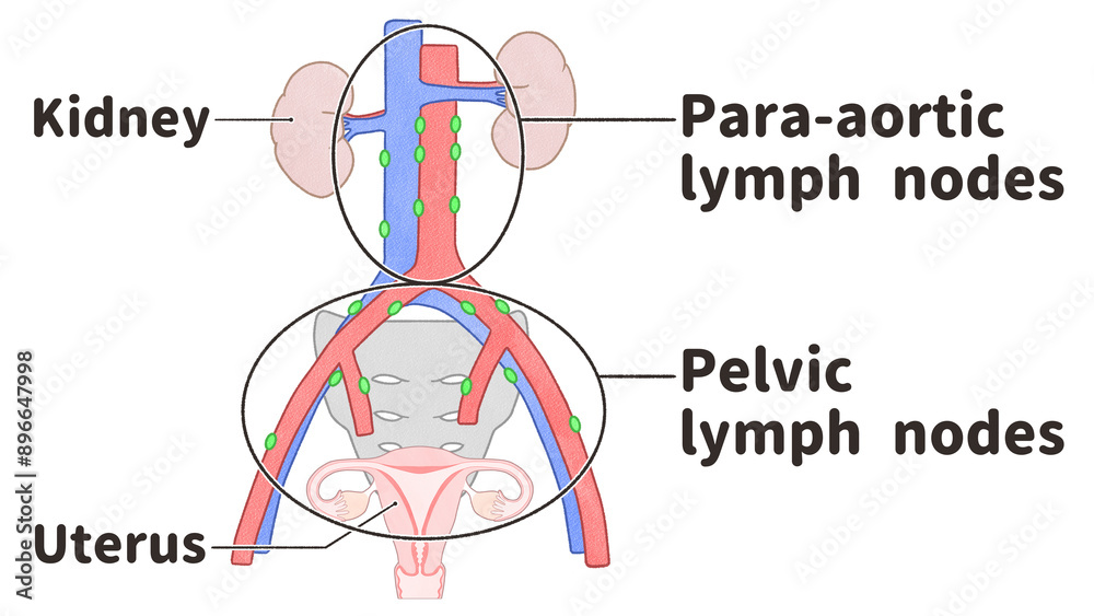 The pelvic and para-aortic lymph nodes Labeled diagram PNG Stock ...