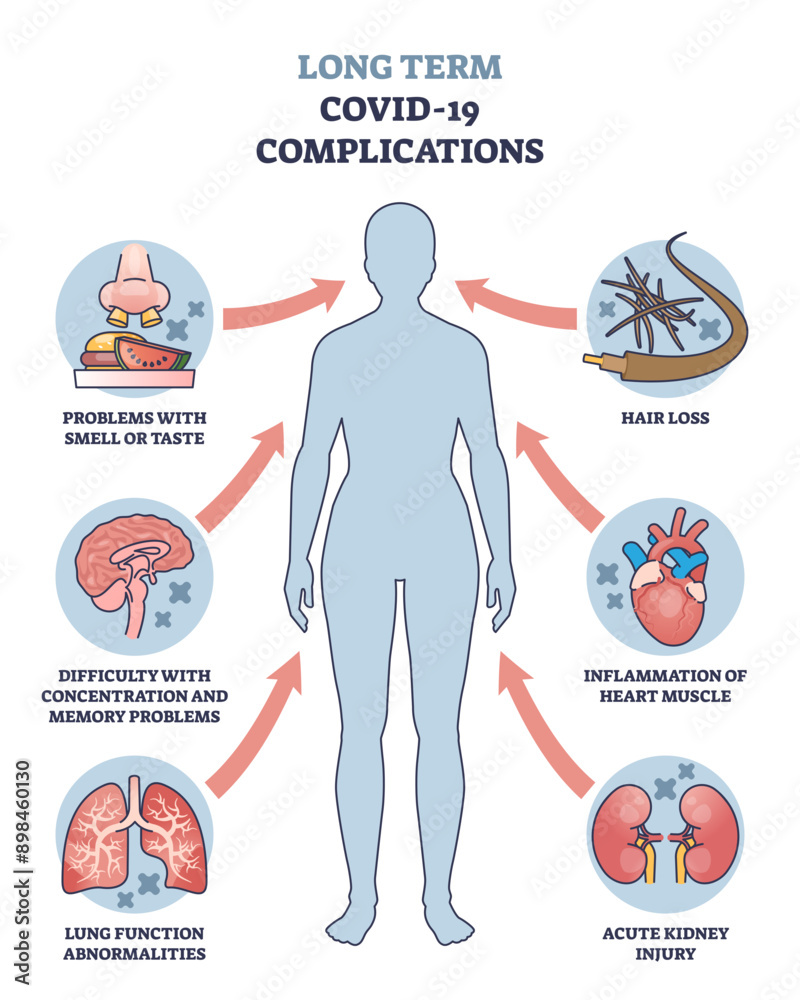 Long term COVID 19 complications with medical symptoms outline diagram ...