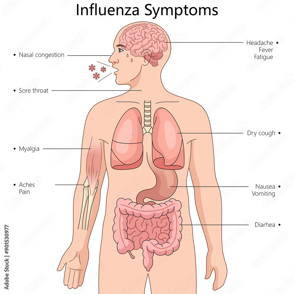 symptoms of influenza in different parts of the human body diagram hand ...