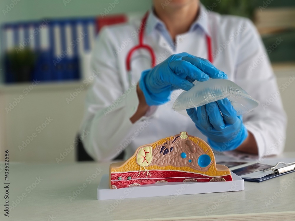 Doctor anatomical model of breast and silicone breast implant Stock ...
