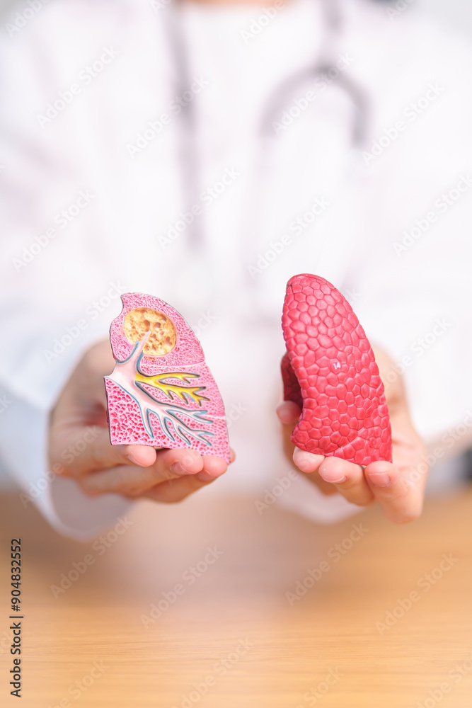 Doctor with Smoker and normal Lung anatomy for Disease. Lung Cancer ...