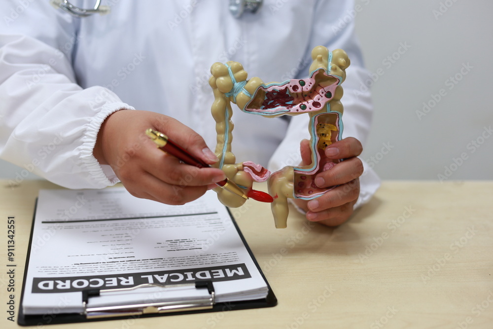 The intestine, comprising the small and large intestines, is a long ...