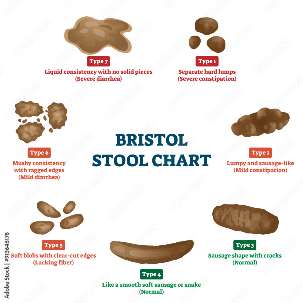 Bristol stool chart tool for faeces type classification illustration ...
