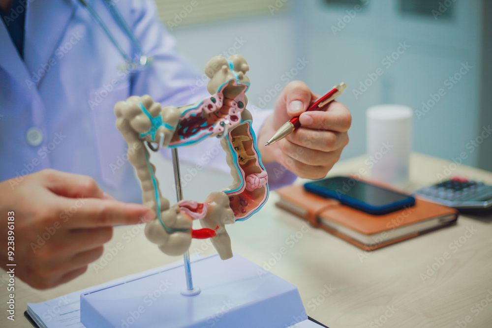 Colon surgeon holding anatomical model for diagnosis and treatment in ...