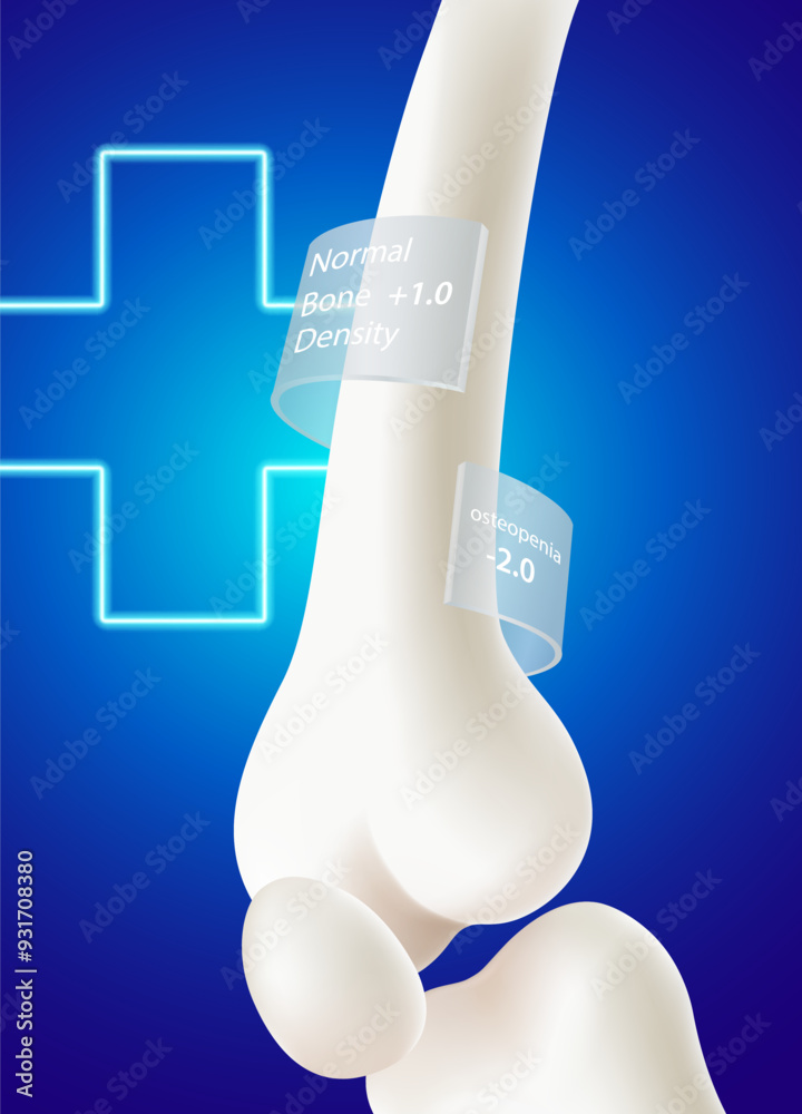 Bone mass test with modern technology by expert doctors. Analyze the ...