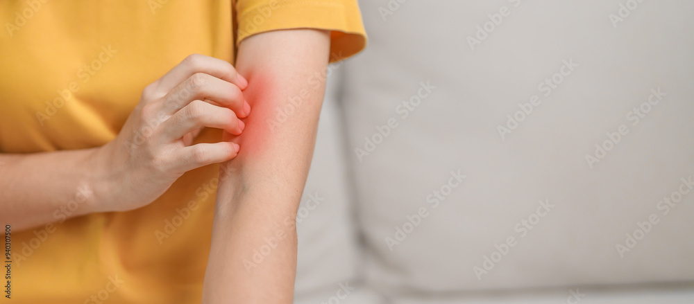 woman itching and scratching itchy arm. Sensitive Skin Allergic ...