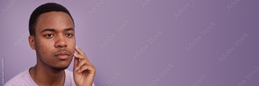 Young african american man scratched face with skin problems. Red spots ...