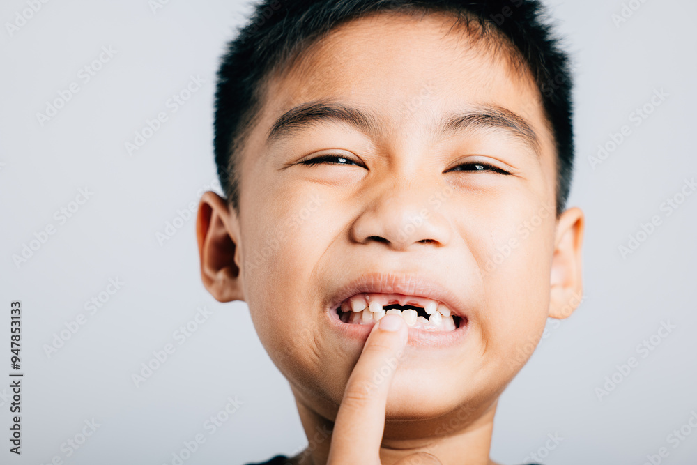 Preschooler wide grin shows growing molar gap signifying child dental ...