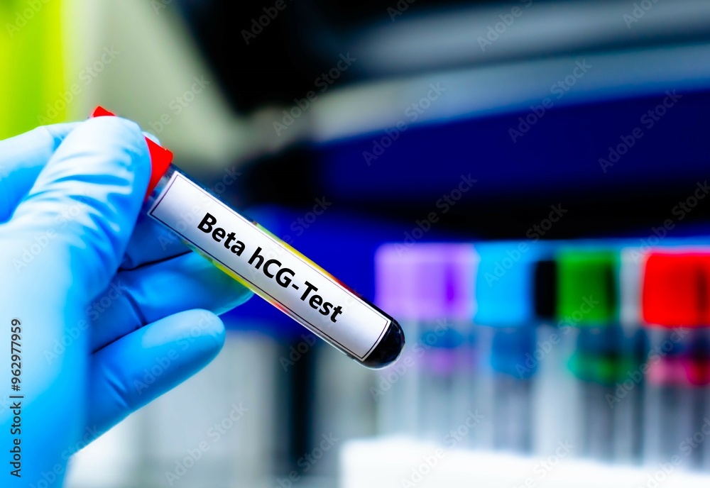 Blood sample tube for beta-hCG test analysis. Stock Photo | Adobe Stock