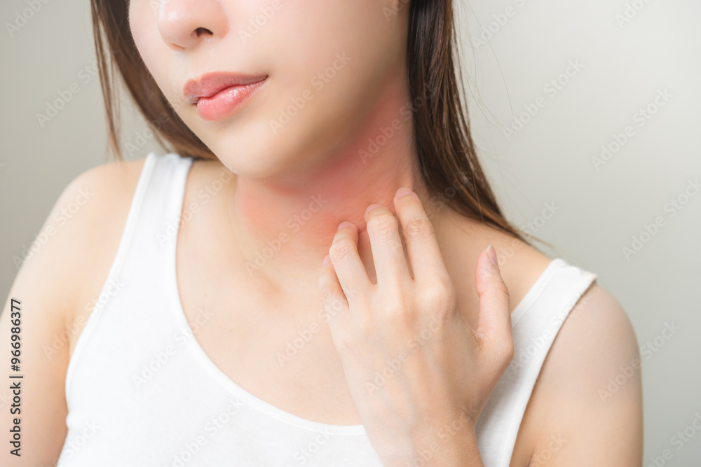 Dermatology concept, asian young woman, girl allergy, allergic reaction ...