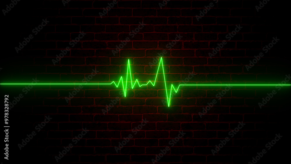 Understanding Heart Health: A Comprehensive Overview of EKG Monitoring ...