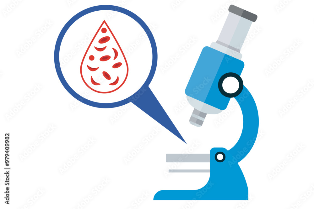 Sickle cell disease ,genetic disorder, red blood cells become crescent ...