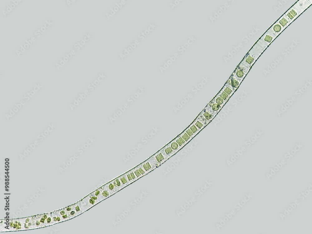 Filamentous algae under the microscope, this species are colonies of ...