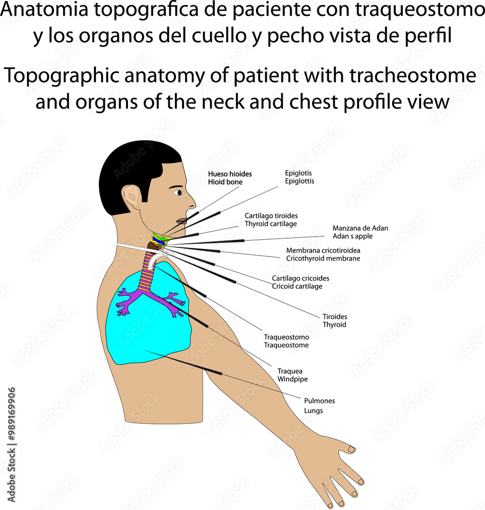 Anatomia topografica paciente con traqueostomo y los organos del cuello ...
