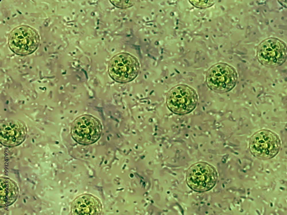 Microscopic view of stool sample showing Cyst of Entamoeba histolytica ...