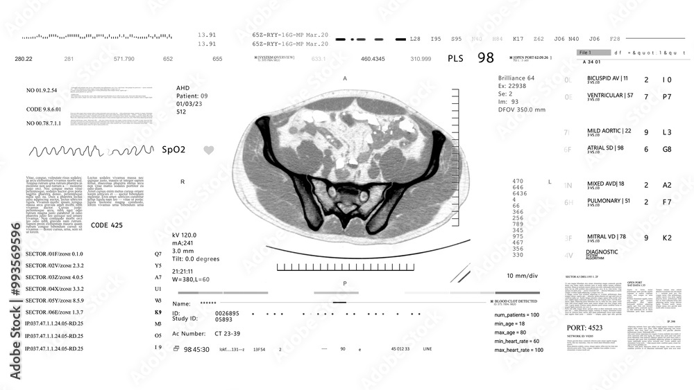 MRI x ray CT Scan. Medical HUD monitoring. Futuristic Technological ...