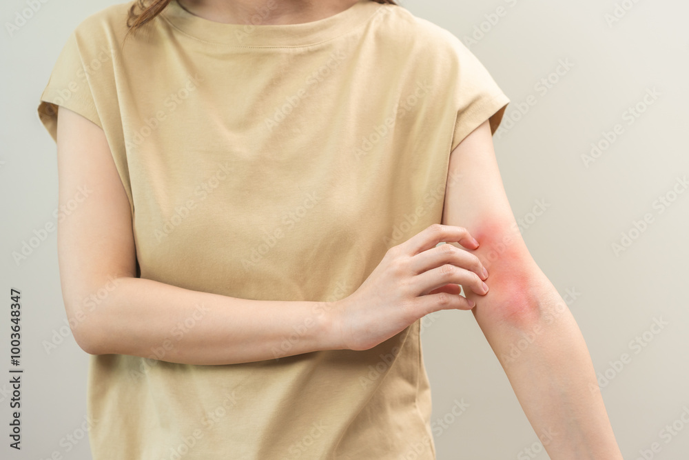 Dermatology asian young woman, girl allergy, allergic reaction from ...