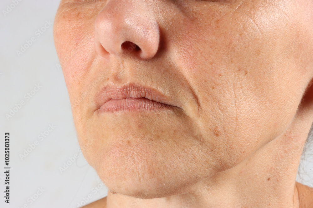 close-up on the wrinkles around the mouth of a 45-year-old woman ...