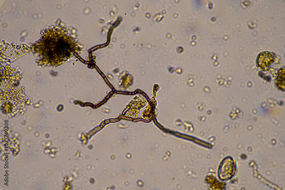 soil fungi storing carbon in the soil. testate amoebae and bacteria ...