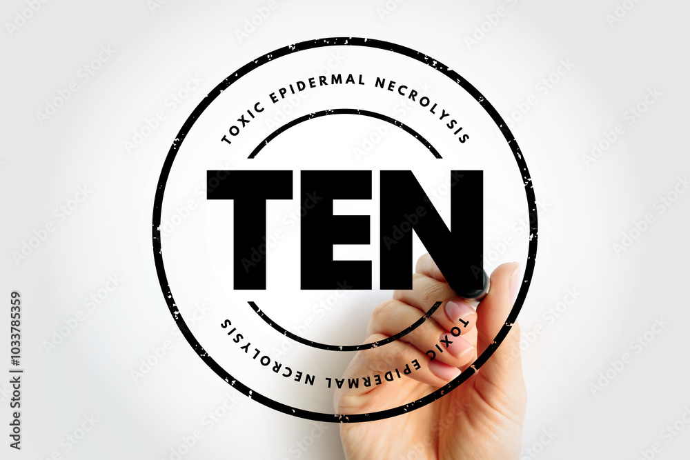 TEN Toxic Epidermal Necrolysis - life-threatening skin disorder ...