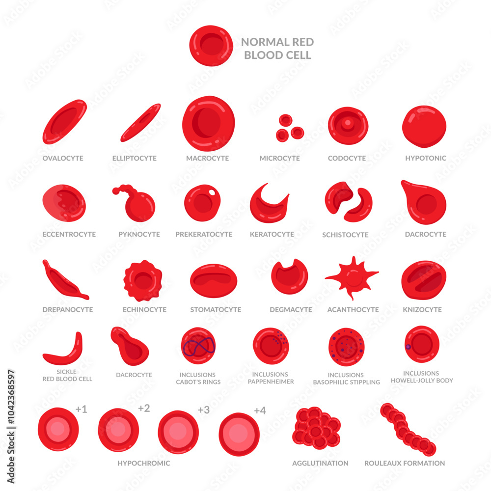 Vector de Stock Poikilocytosis of Erythrocytes Shape of red blood cell ...