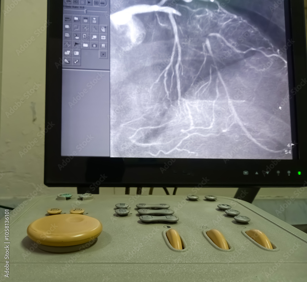Coronary angiogram machine control board with monitor to examination ...