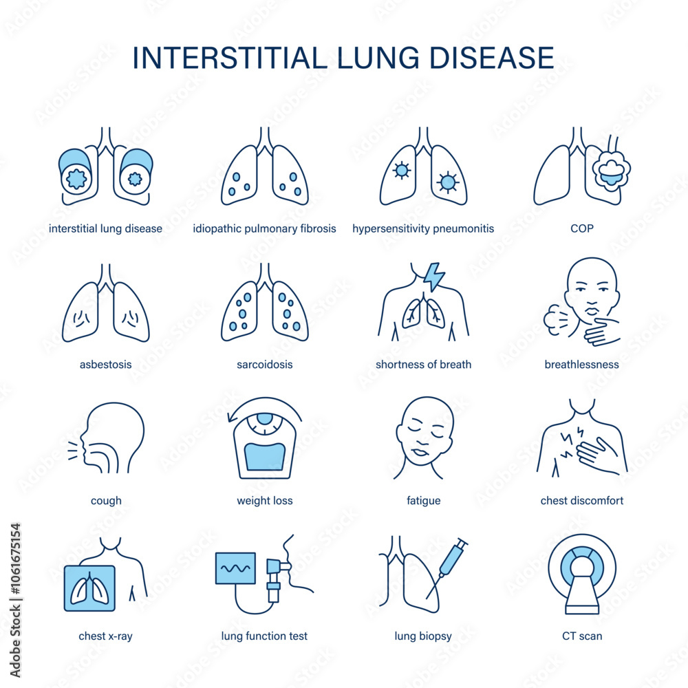 Interstitial Lung Disease symptoms, diagnostic and treatment vector ...