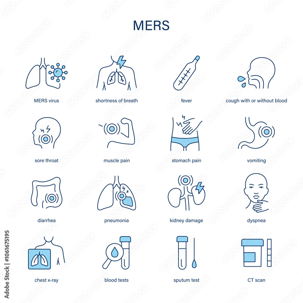 MERS, Middle Eastern Respiratory Syndrome symptoms, diagnostic and ...