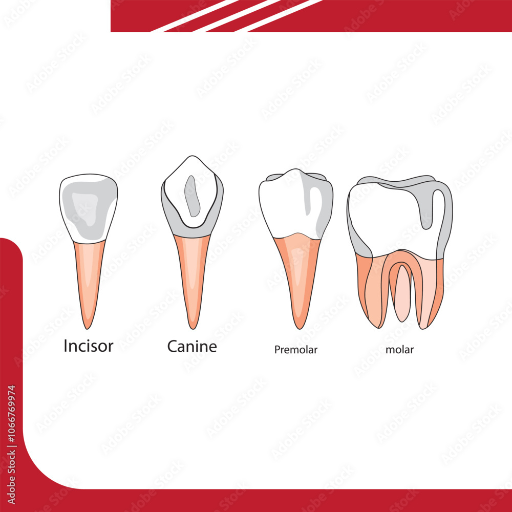 dental disease with pain and inflammation. Medical illustration of ...