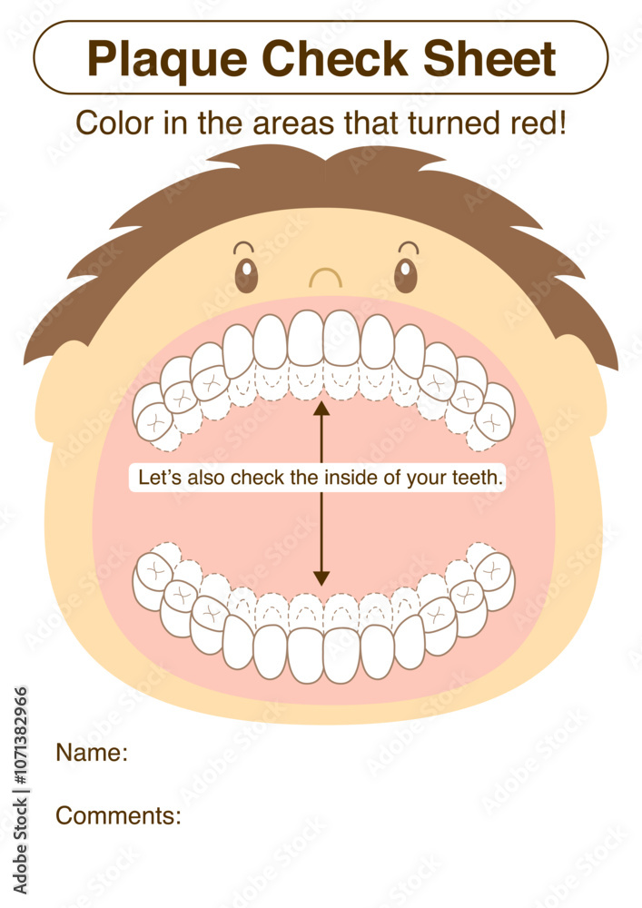 Mixed Dentition Period Plaque Check Sheet - Staining Illustration Stock ...