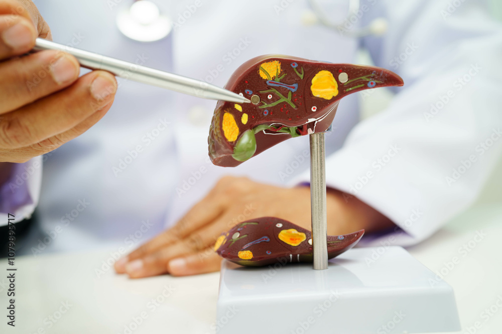 Pancreatitis, pancreatic cancer, Asian doctor with pancreas ...