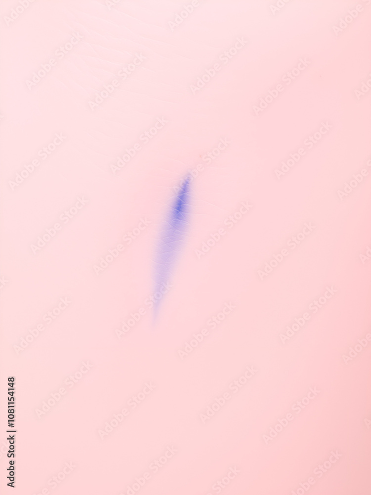 Varicose veins. Blue blood vessel visible through the skin. Vascular ...