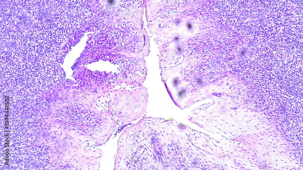 Anatomy and Histology of Bilateral Tonsils and Parotid Human Cells with ...