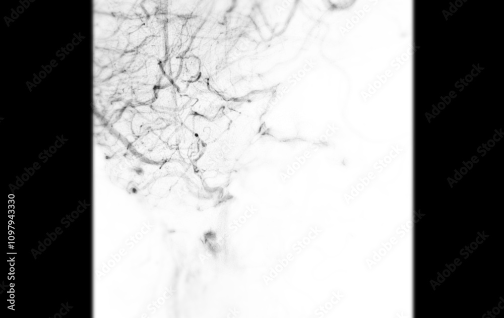 A detailed cerebral angiogram showcasing intricate blood vessels in the ...