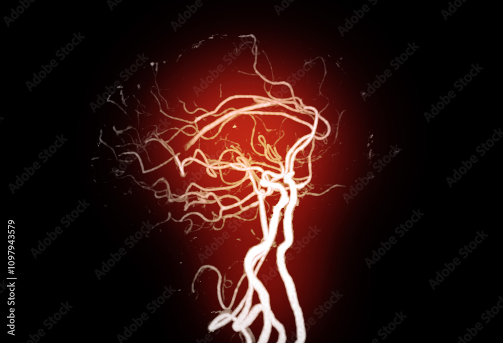 The contrast-enhanced CT Angiography (CTA) of the brain and neck ...