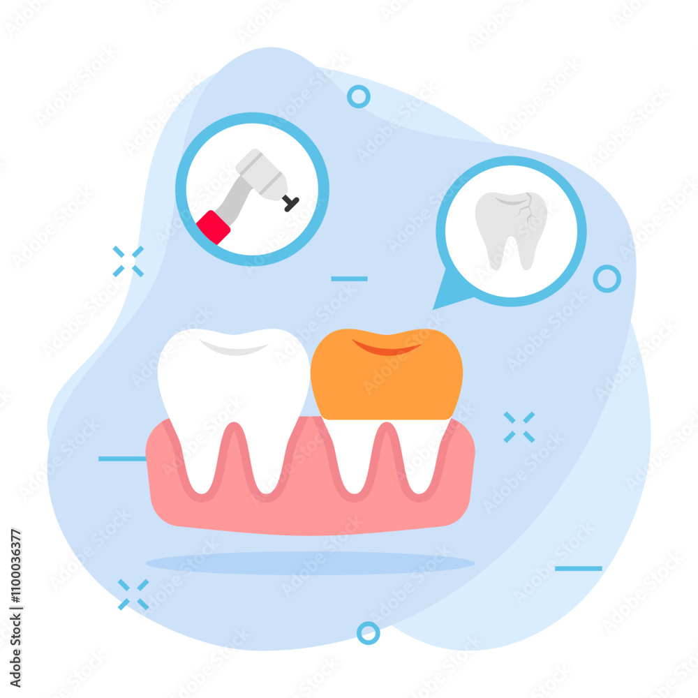 Restorative dentistry or Dental fillings concept, Removing and Applying ...