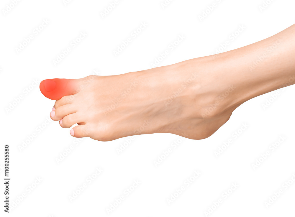 Big toe pain, joint ache, and inflammation. Sore foot with sprain ...