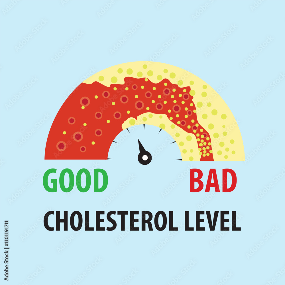 Cholesterol level on blocked blood vessel medical diagram. Meter gauge ...